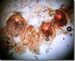 TGVET: Trombiculiasi